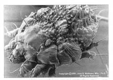 La gale - Conseils - Sante-dz