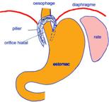 Le reflux gastro-œsophagien - Actualités - Sante-dz