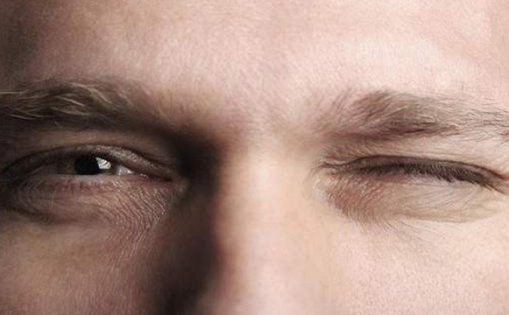 Les fasciculations de l’œil - Actualités - Sante-dz